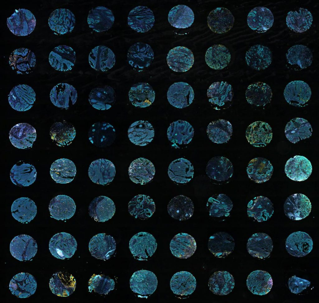 Multiplex IHC Service | Nilogen Oncosystems